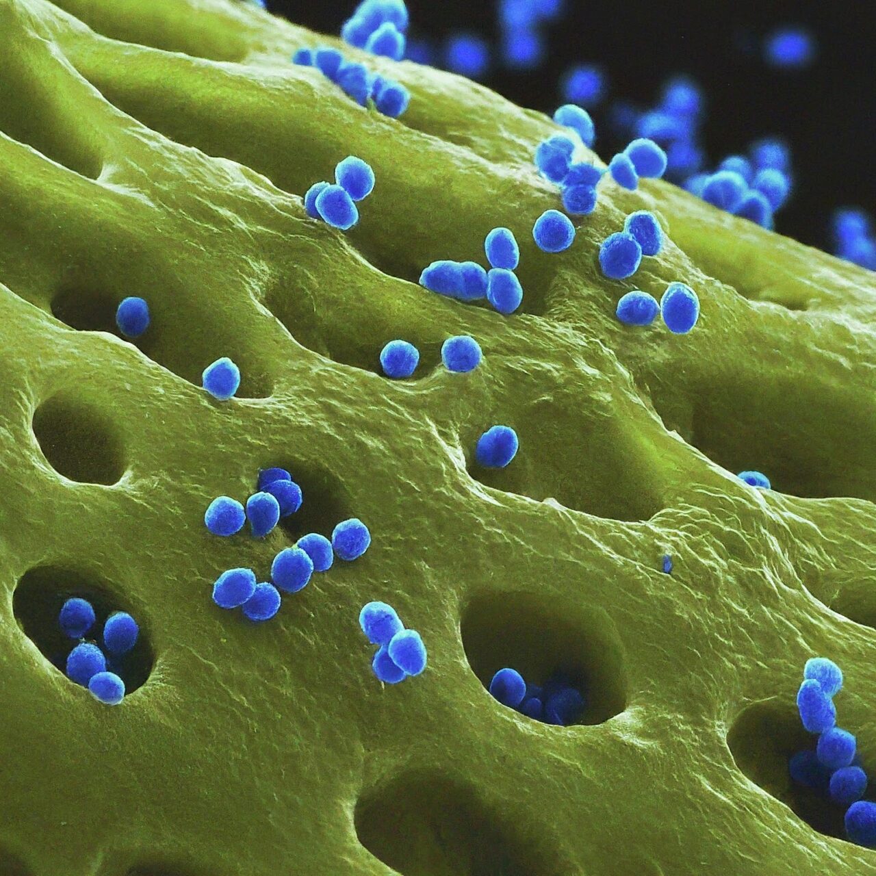 Bacterial Biofilm treatment, Diabetes Wound Treatment, Wound Treatment ...